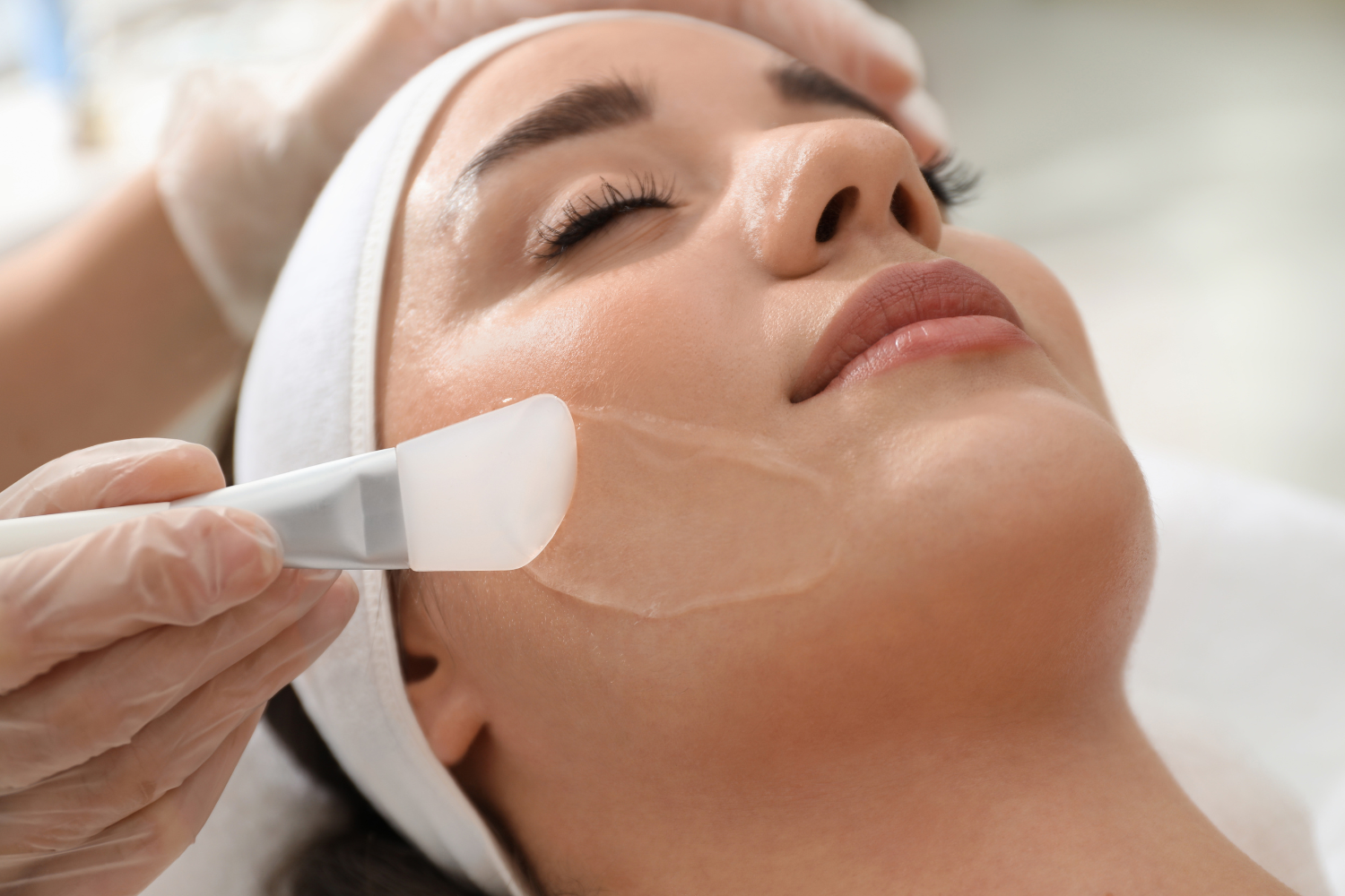 Peeling superficial – Dermaderm